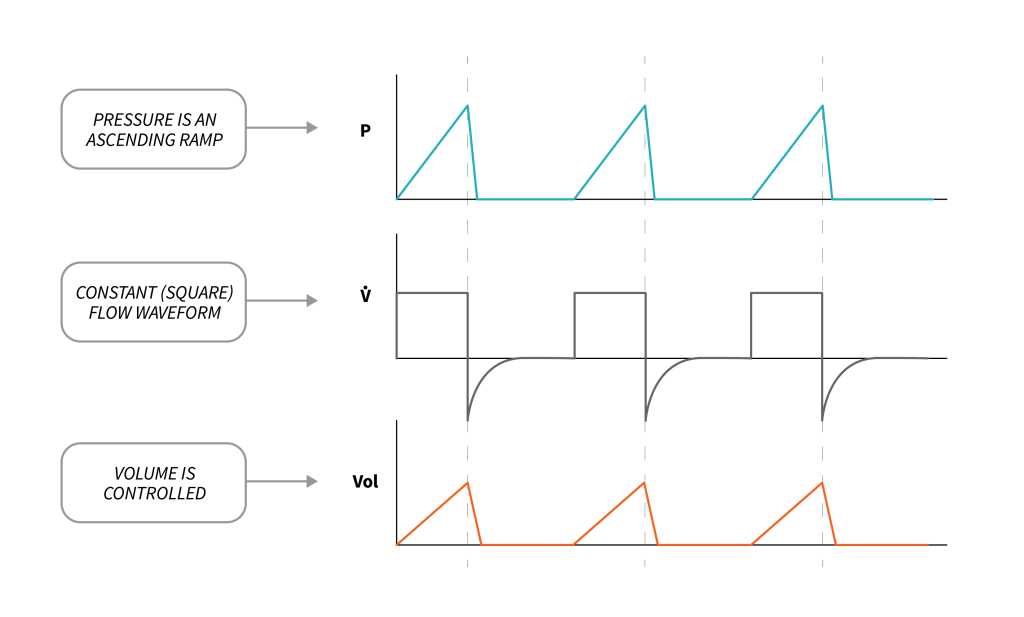 3.4 Volume Control Ventilation – Breathe Easy: RT Student Resource for Mechanical Ventilation