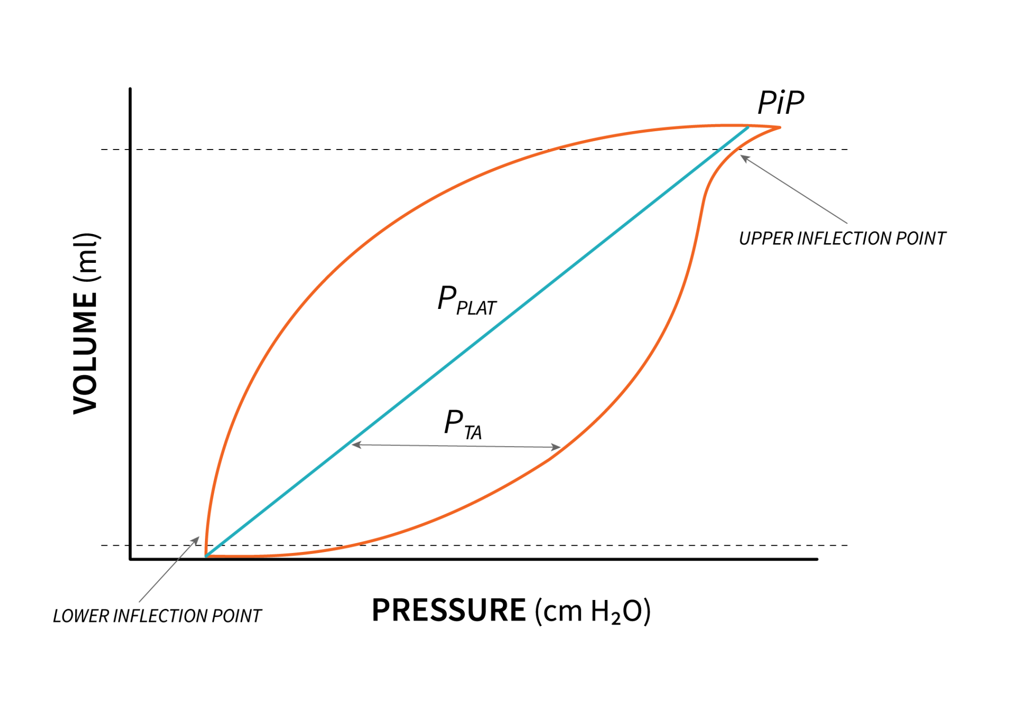 8.6 Patient-Ventilator Interaction & Graphic Representation of Ventilation – Breathe Easy: RT ...