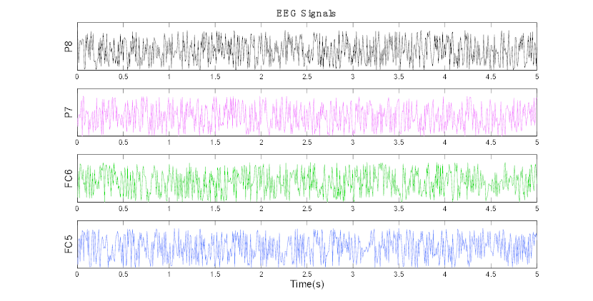 N01: Electroencephalogram (EEG) – Real Analysis of Data in Psychology, Neuroscience & Behaviour